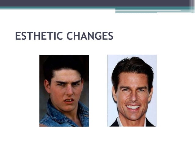 Biomechanics of edentulous state | PPTX