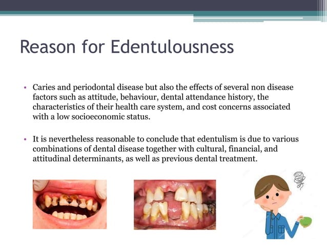 Biomechanics of edentulous state | PPTX