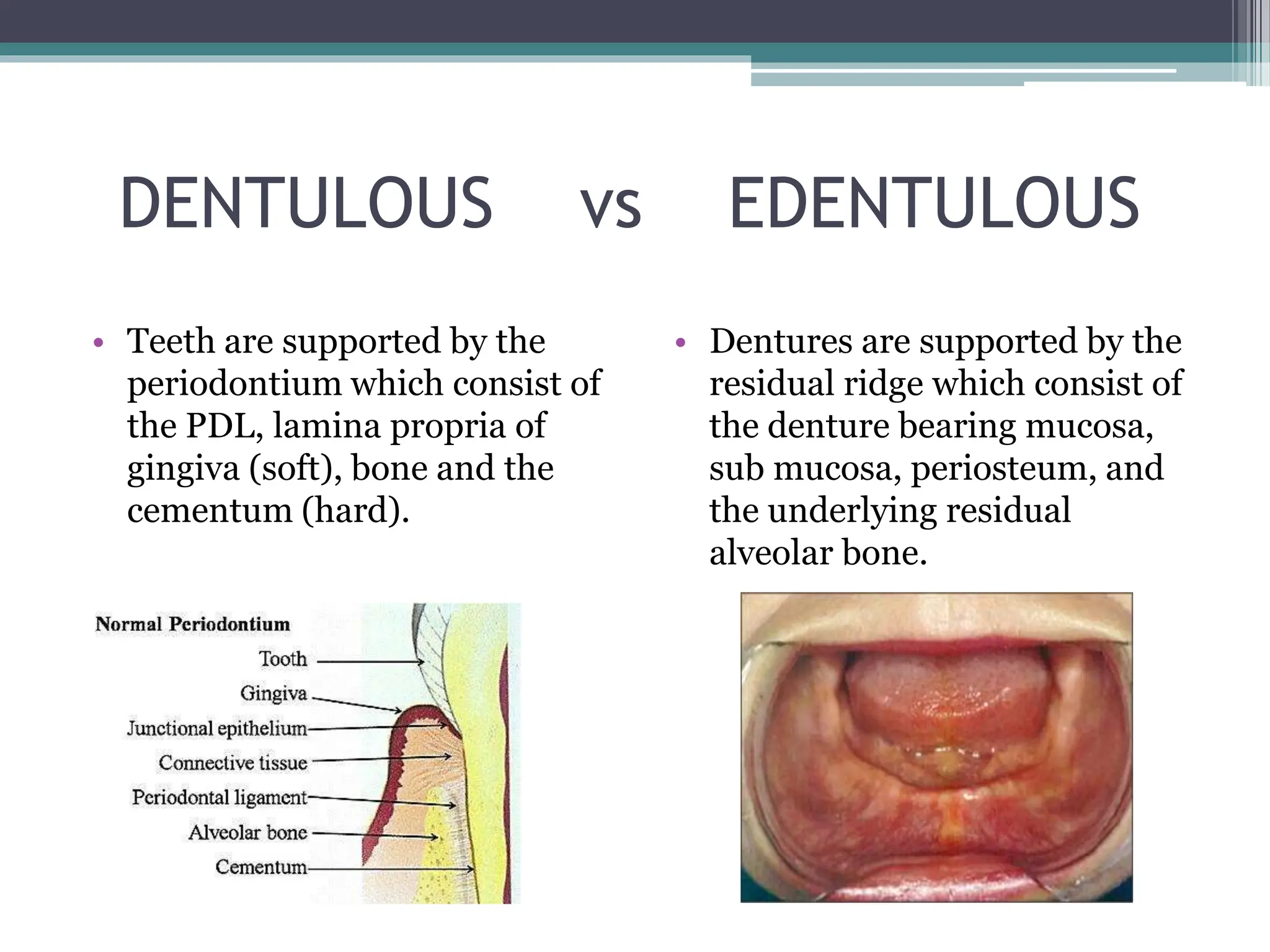biomechanicsofedentulousstate-200719071419 (1).pptx
