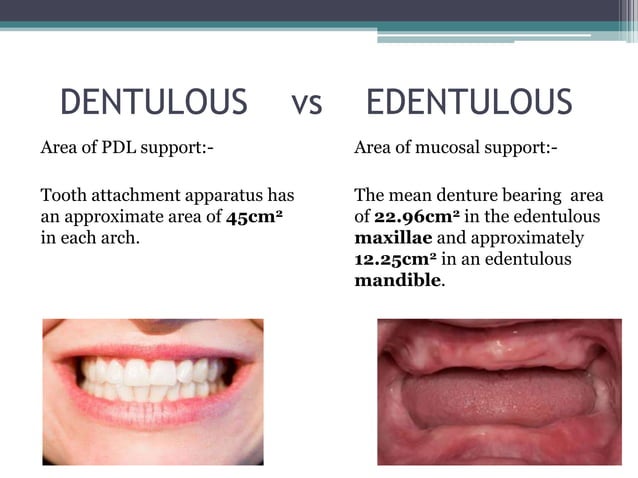 biomechanicsofedentulousstate-200719071419 (1).pptx