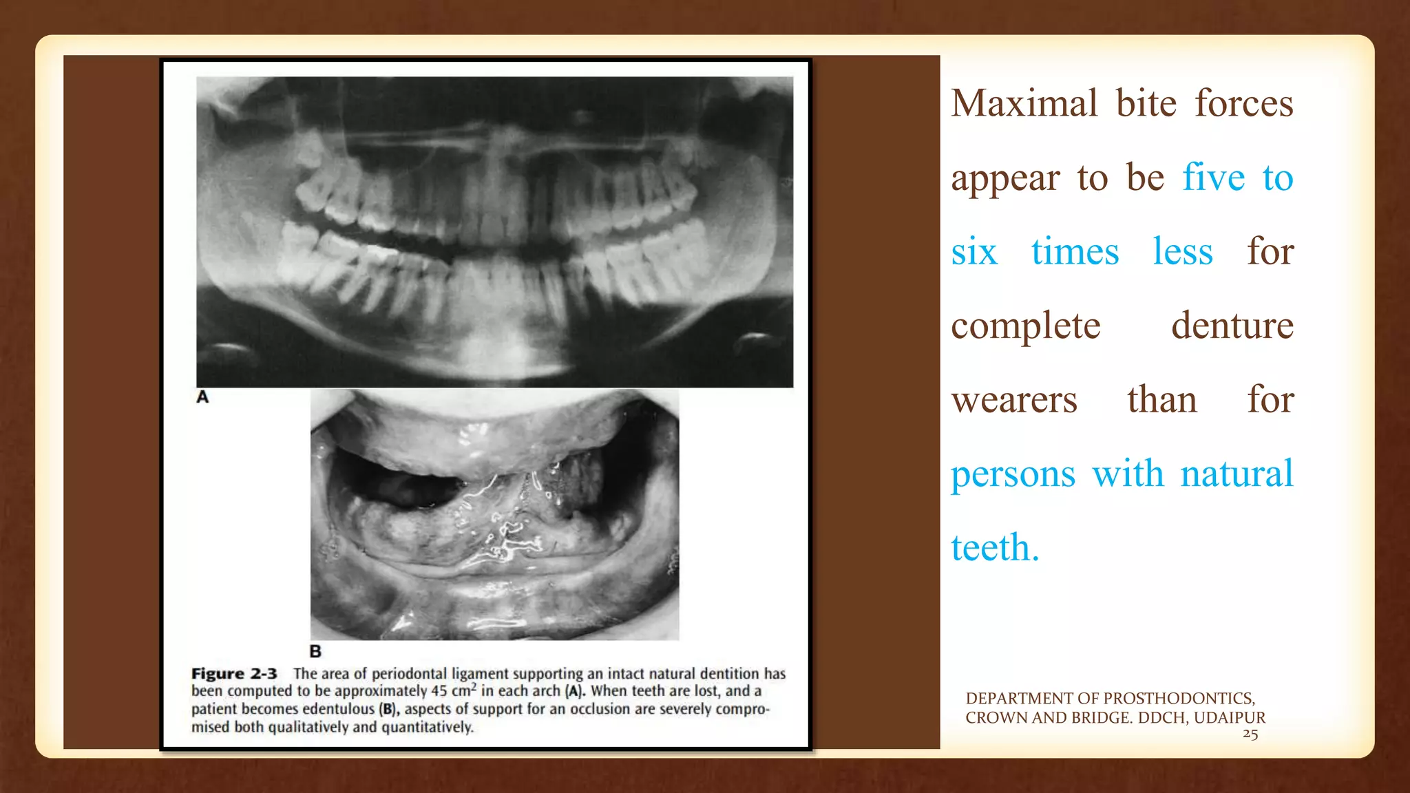 Biomechanics of edentulous state new | PPTX