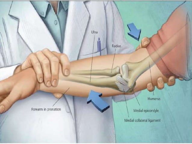 BIOMECHANICS OF ELBOW COMPLEX 1.pptx