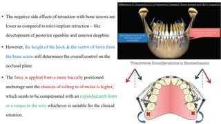 Biomechanics of extra alveolar mini-implants | PPTX