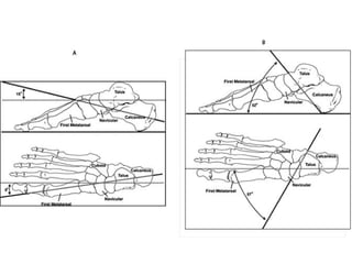 Biomechanics of foot | PDF