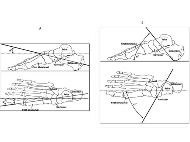 Biomechanics of foot | PDF