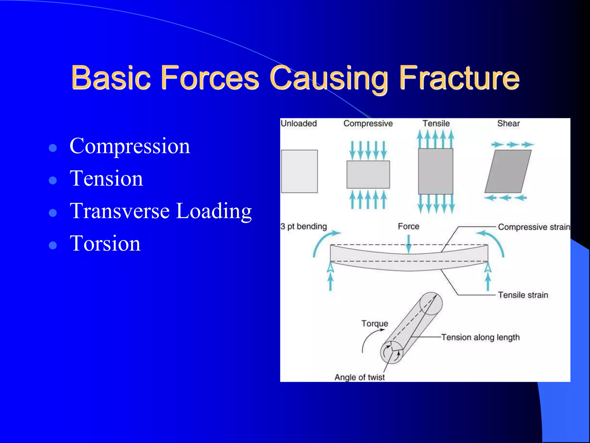 Biomechanics of Fracture and Fixation Justice 10.3.2005 (1).pptx