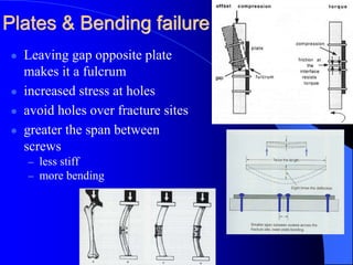 Biomechanics of Fracture and Fixation Justice 10.3.2005 (1).pptx
