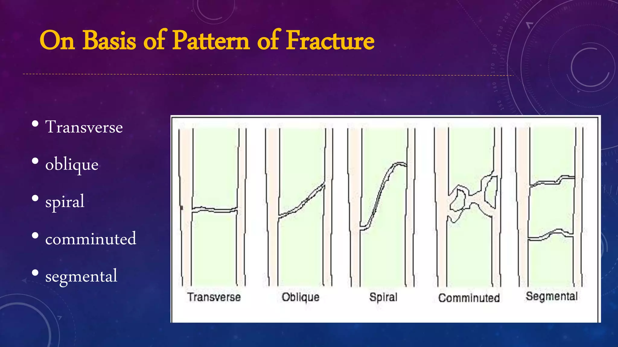 Biomechanics of fracture and fracture healing | PPTX
