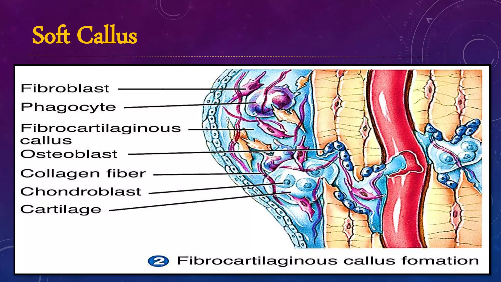 Biomechanics of fracture and fracture healing | PPTX