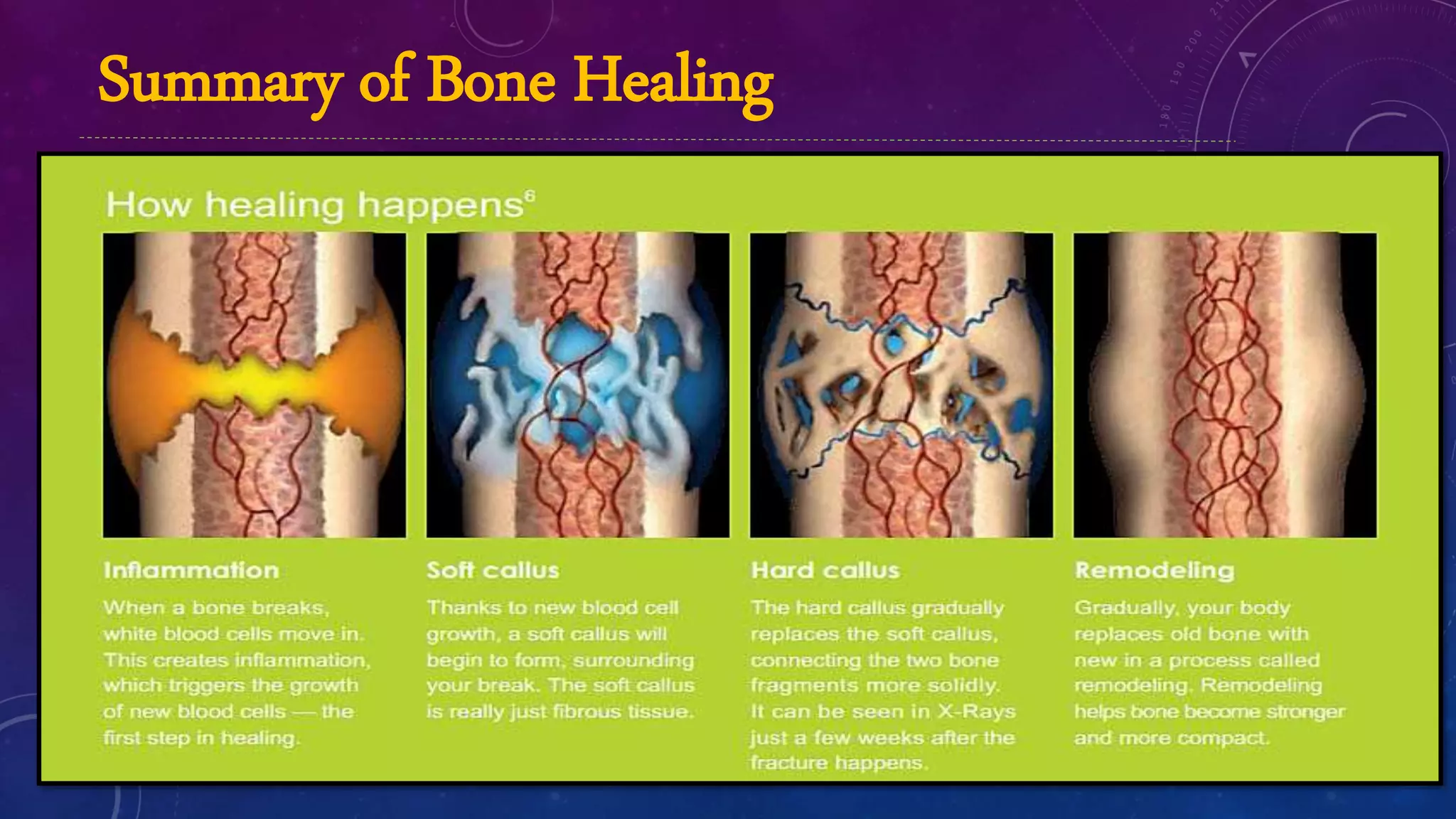 Biomechanics of fracture and fracture healing | PPTX