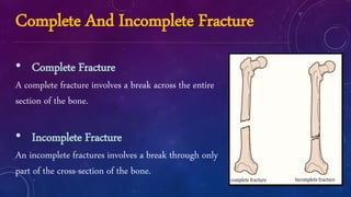 Biomechanics of fracture and fracture healing | PPTX