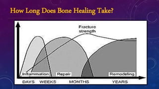 Biomechanics of fracture and fracture healing | PPTX