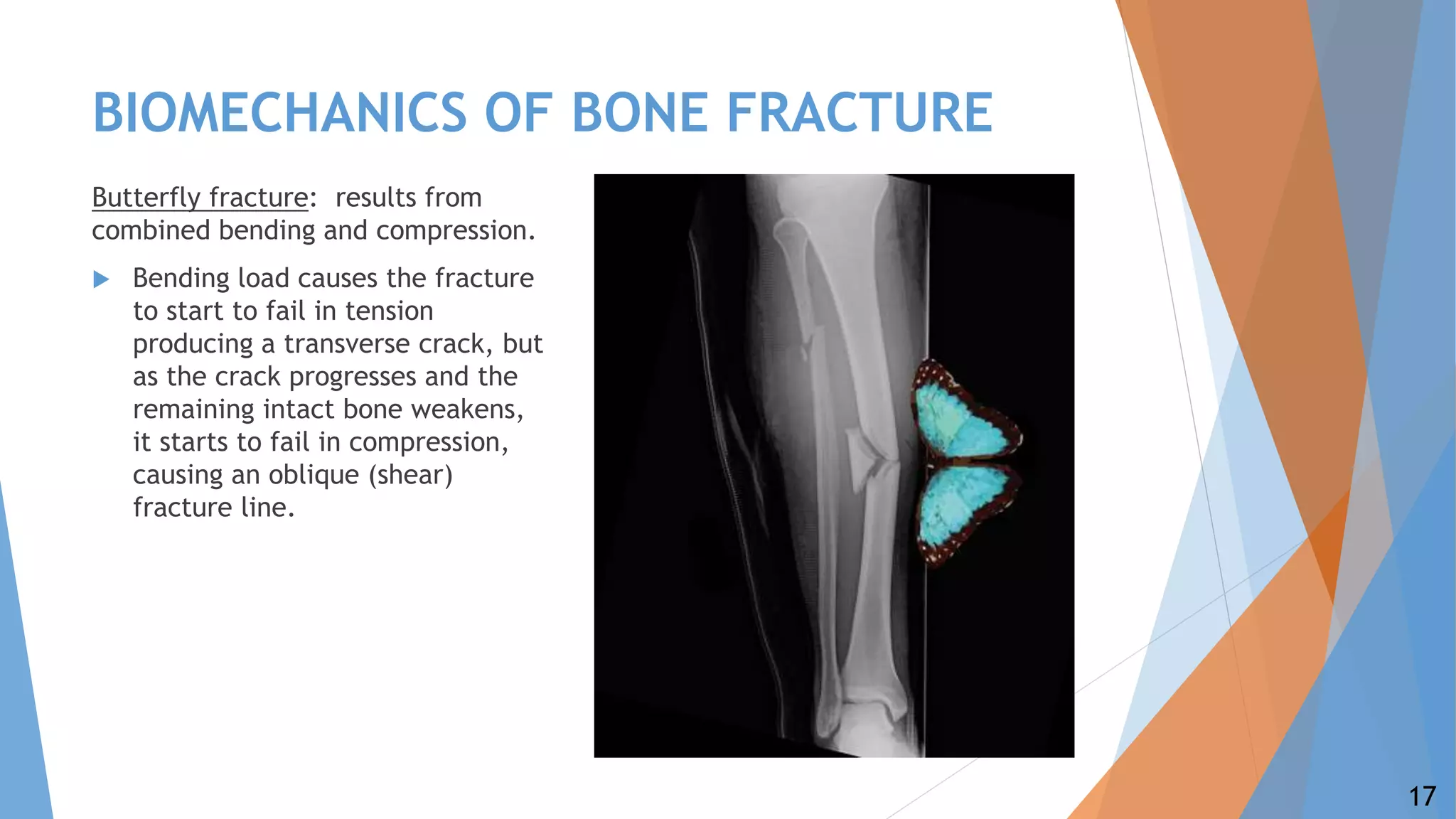 Biomechanics of Fractures and Fracture Fixation.pptx