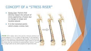 Biomechanics of Fractures and Fracture Fixation.pptx