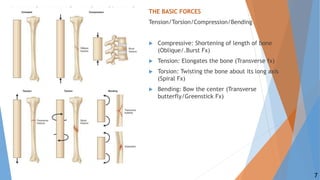 Biomechanics of Fractures and Fracture Fixation.pptx