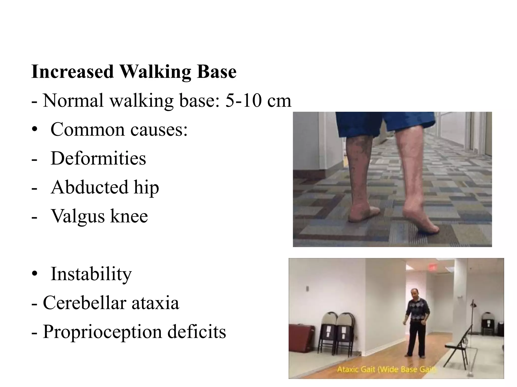 Biomechanics of Gait, Posture and ADL | PPTX