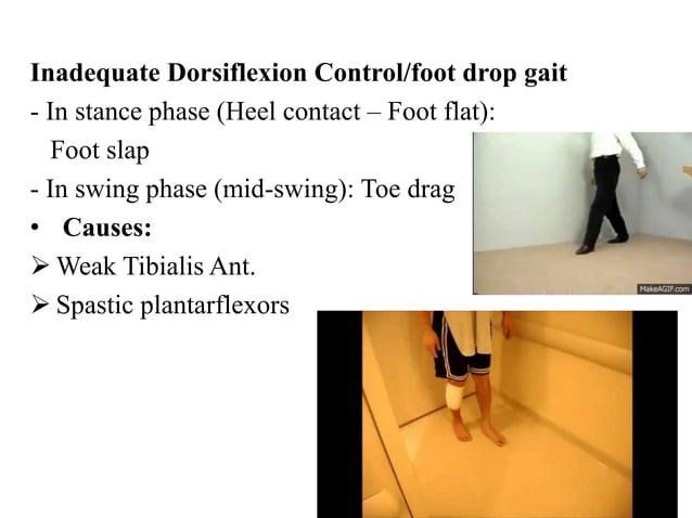 Biomechanics of Gait, Posture and ADL | PPTX
