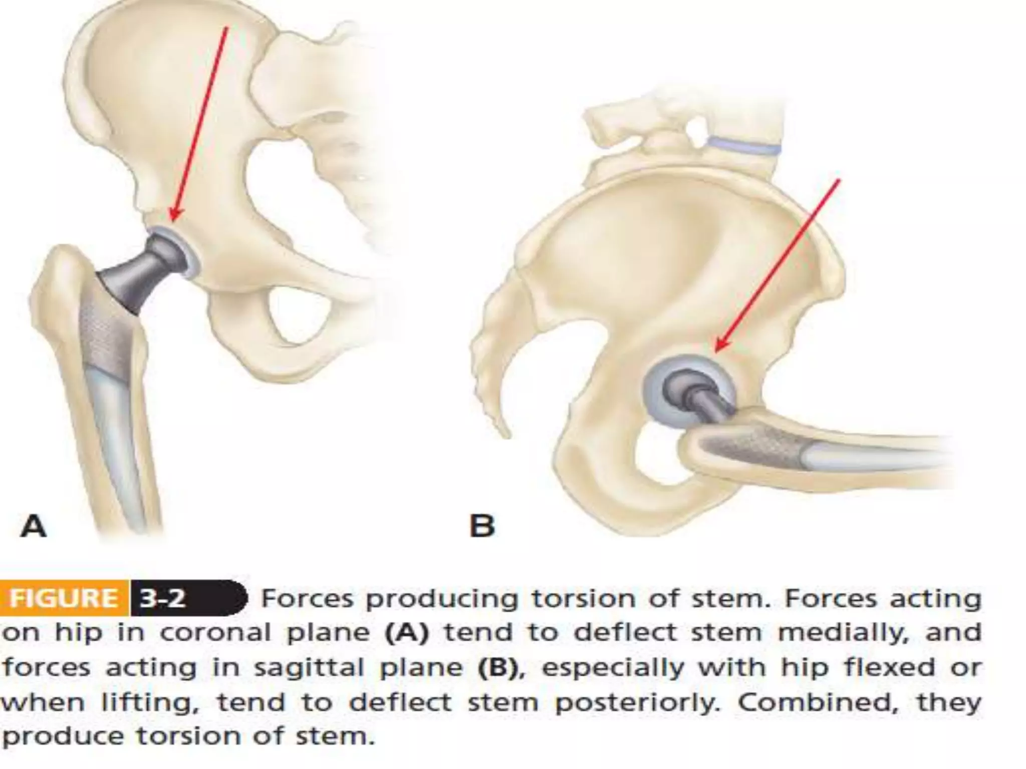 Biomechanics of hip | PPTX