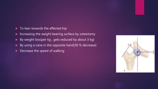 Biomechanics of hip | PPT