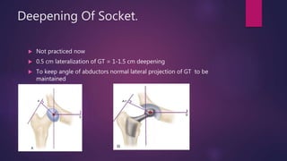 Biomechanics of hip | PPT