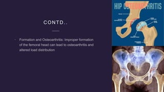 Hip Joint Biomechanics & its Kinetics and Kinematics | PPTX