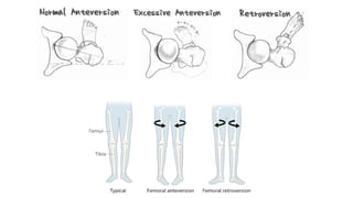 Biomechanics of hip 2.pptx
