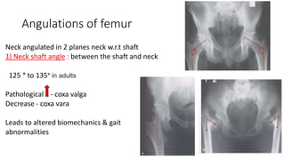 Biomechanics of hip 2.pptx | Death, Injury, or Military Conflict ...