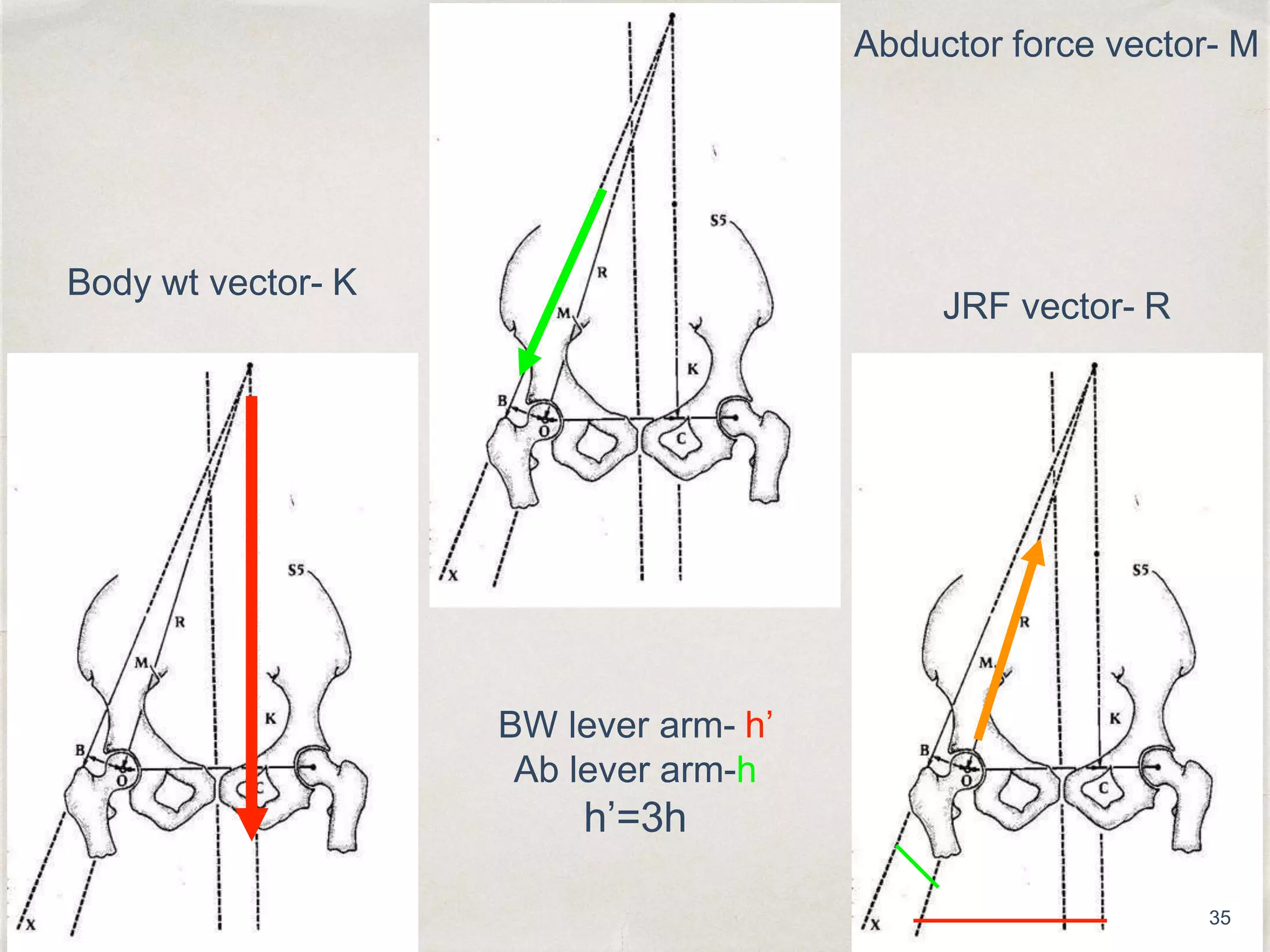 BIOMECHANICS OF HIP JOINT | PPTX | Bone and Joint Conditions | Diseases ...