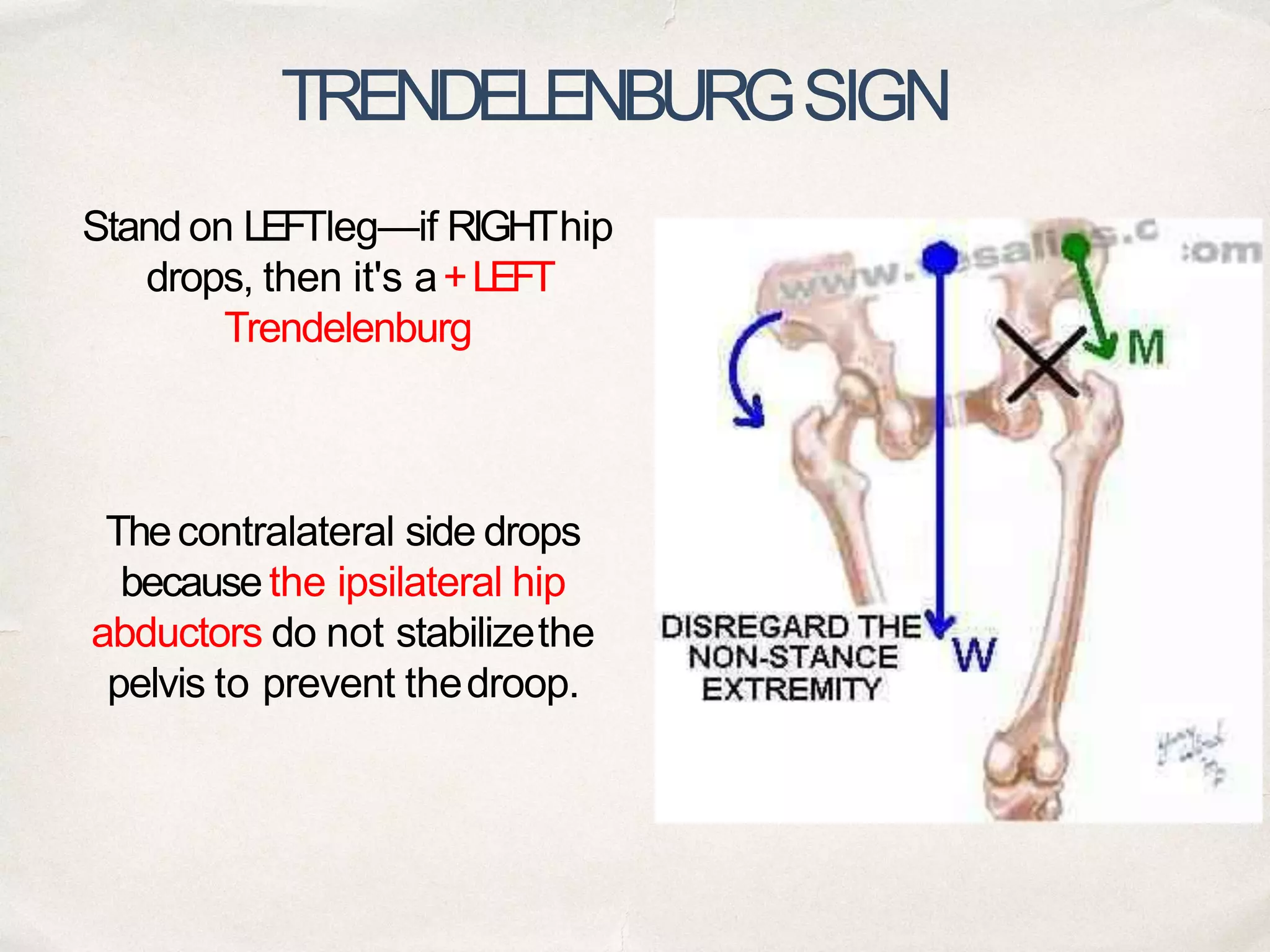 BIOMECHANICS OF HIP JOINT | PPTX