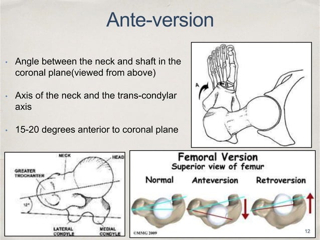BIOMECHANICS OF HIP JOINT | PPTX | Bone and Joint Conditions | Diseases ...
