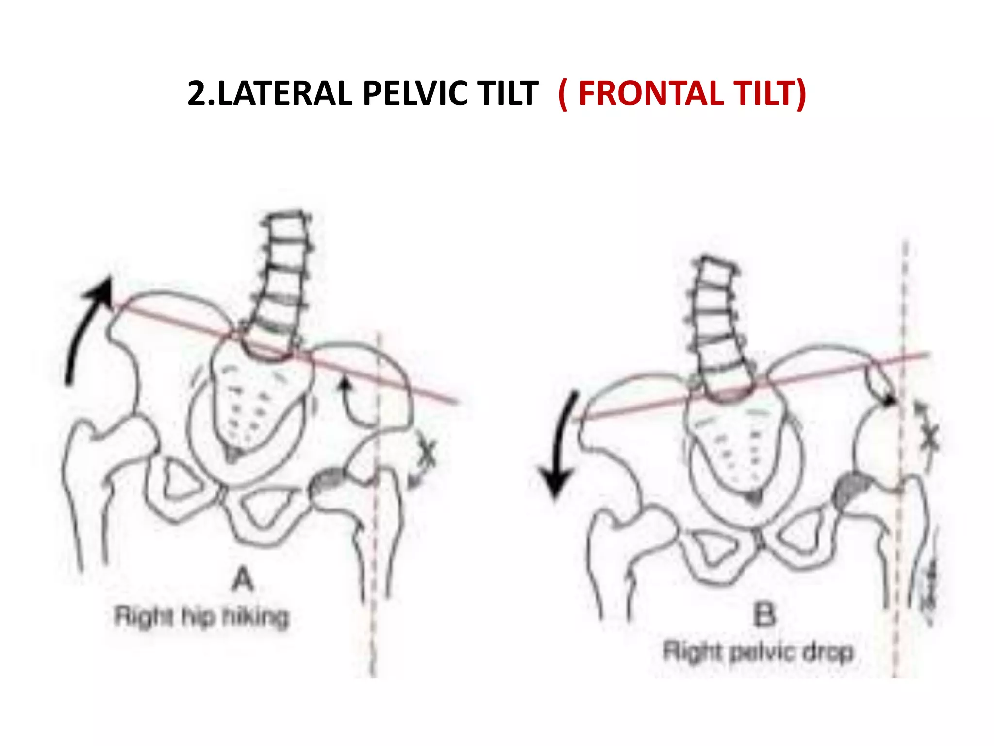 BIOMECHANICS OF HIP JOINT | PPTX