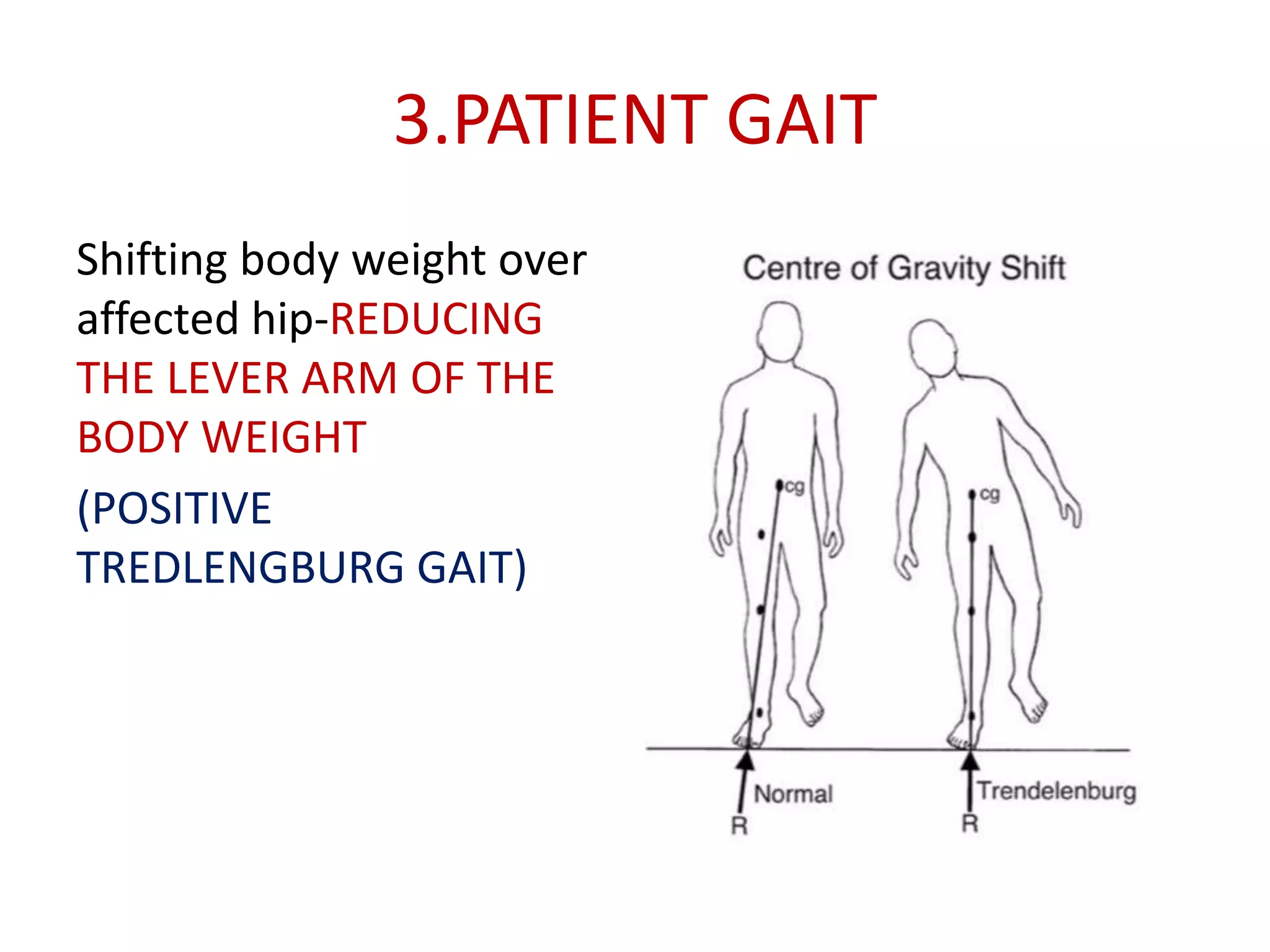 BIOMECHANICS OF HIP JOINT | PPTX