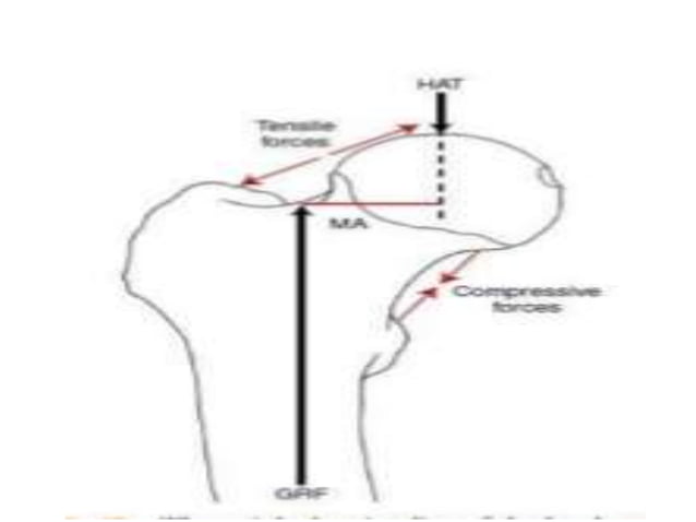 BIOMECHANICS OF HIP JOINT | PPTX | Bone and Joint Conditions | Diseases ...