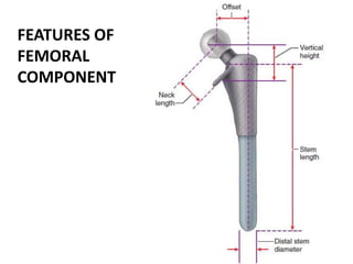 BIOMECHANICS OF HIP JOINT | PPTX