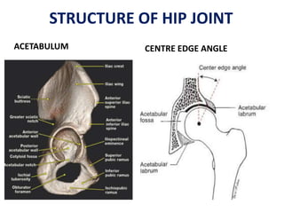 BIOMECHANICS OF HIP JOINT | PPTX