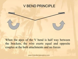 Biomechanics of intrusion appliances final copy copy | PPT