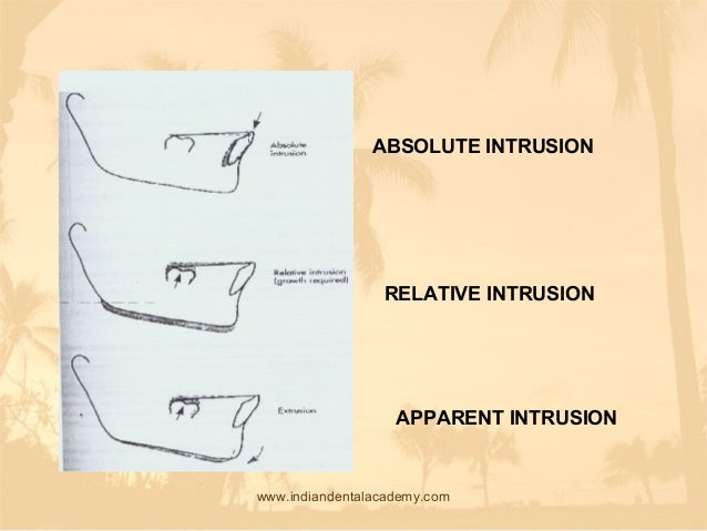 Biomechanics of intrusion appliances final copy copy