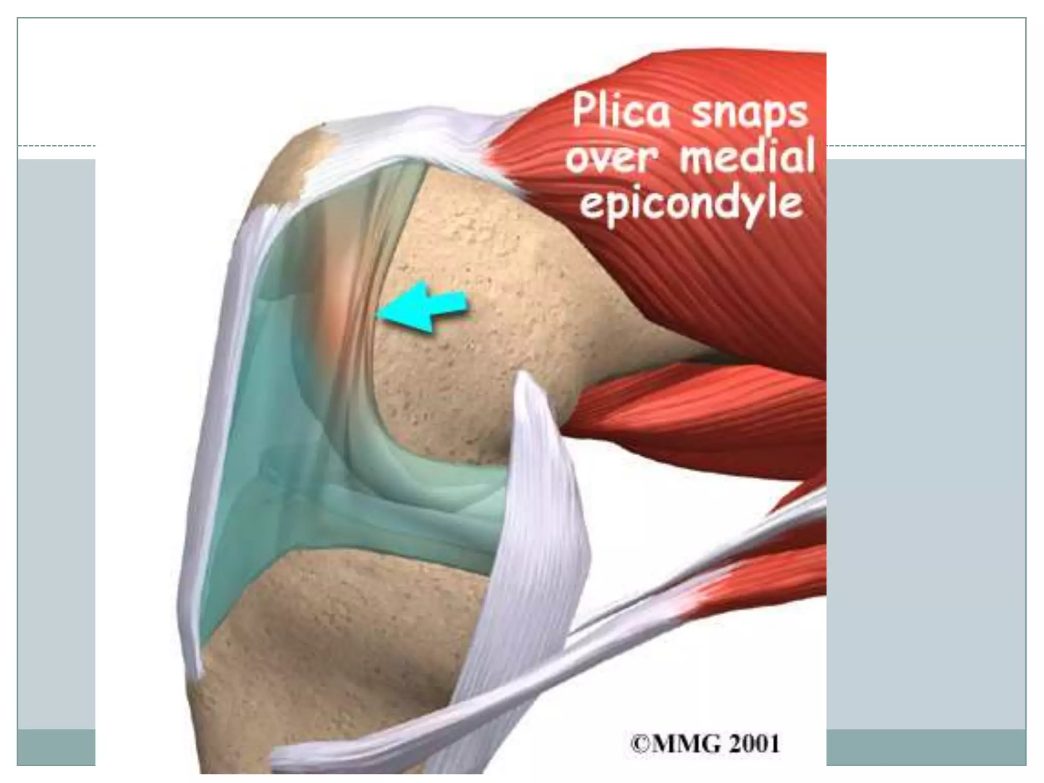 Biomechanics of knee complex 3 | PPTX