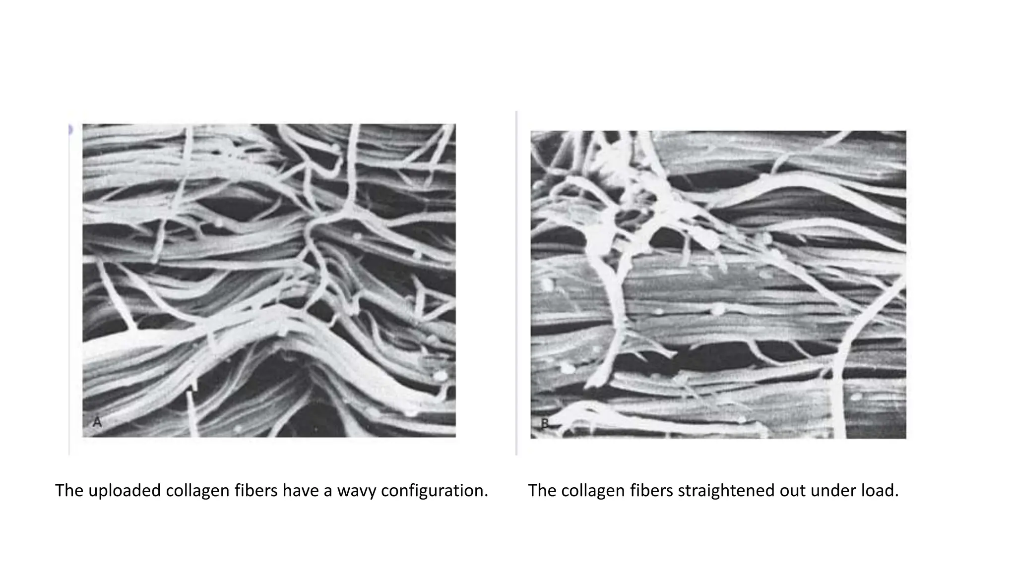 BIOMECHANICS OF LIGAMENT AND TENDONS.pptx