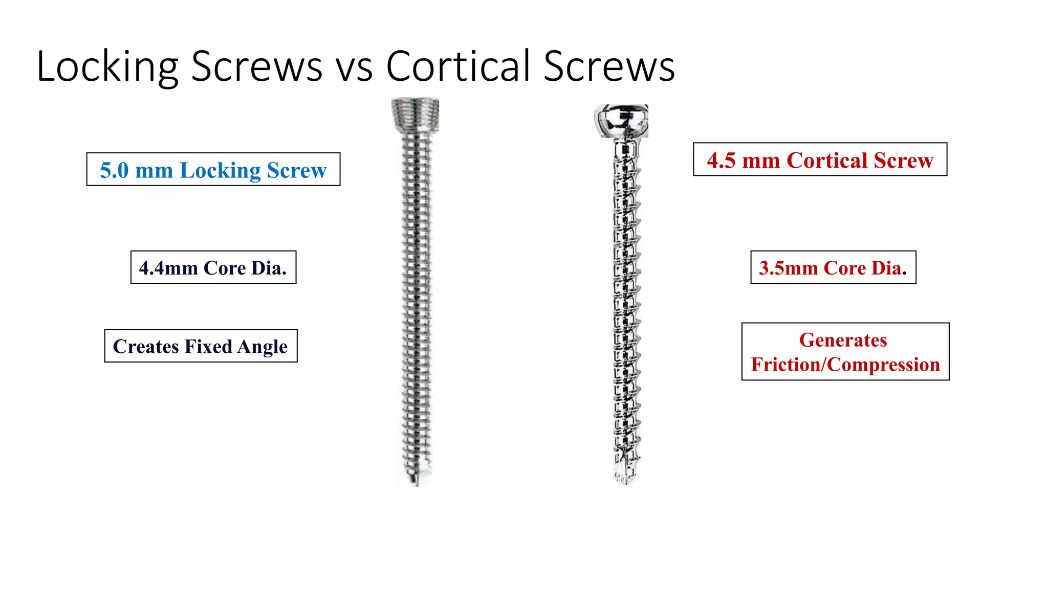 Biomechanics of locking plates | PDF