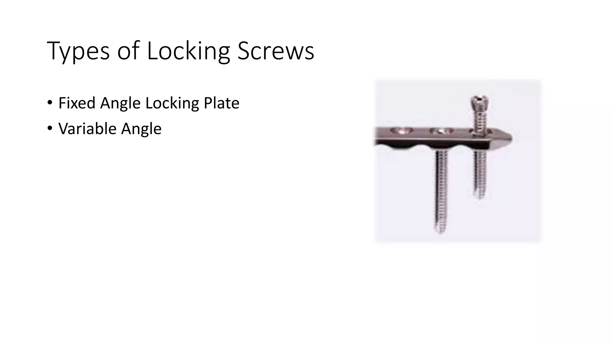 Biomechanics of locking plates | PDF