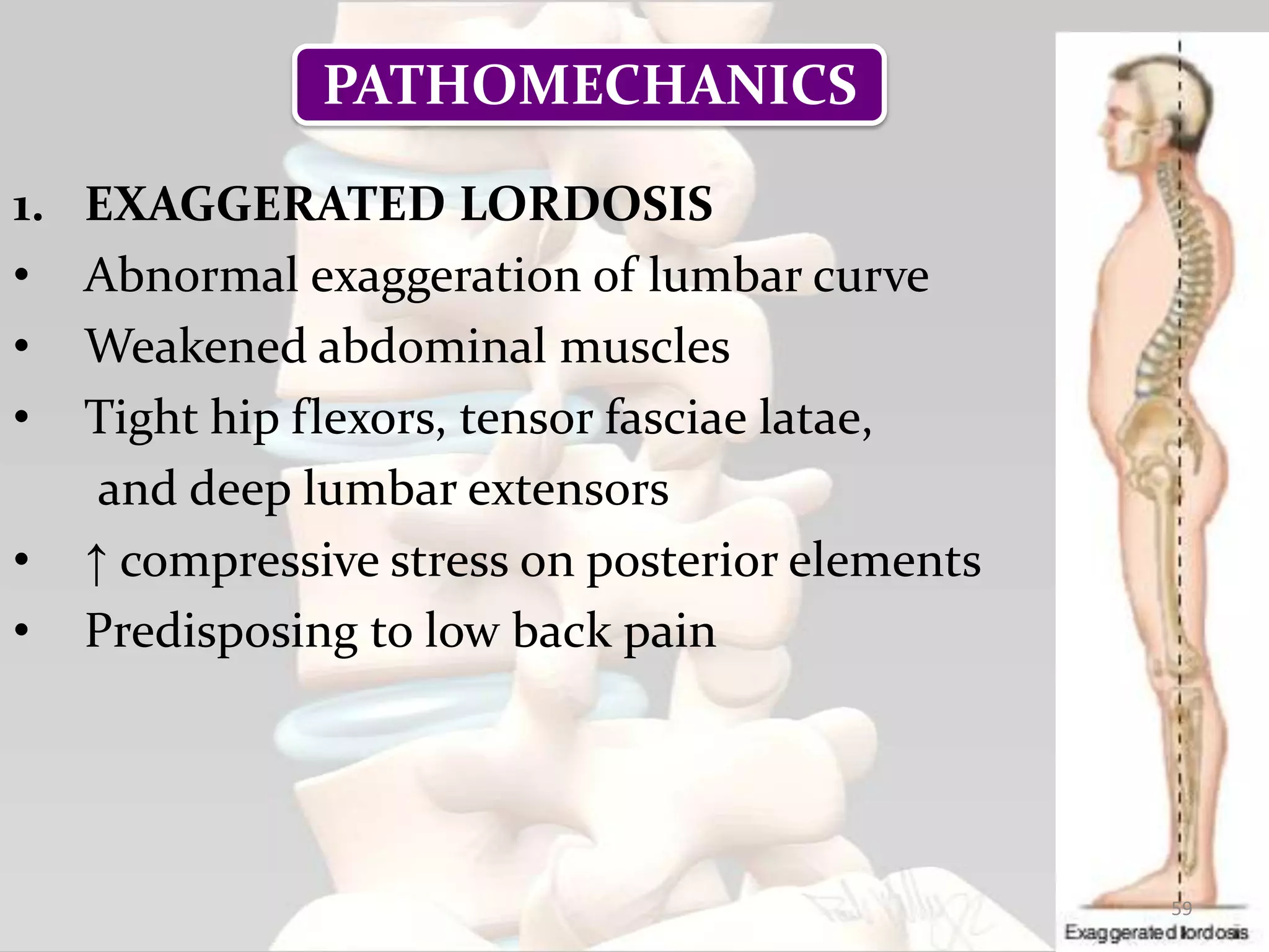 Biomechanics of lumbar spine | PPTX