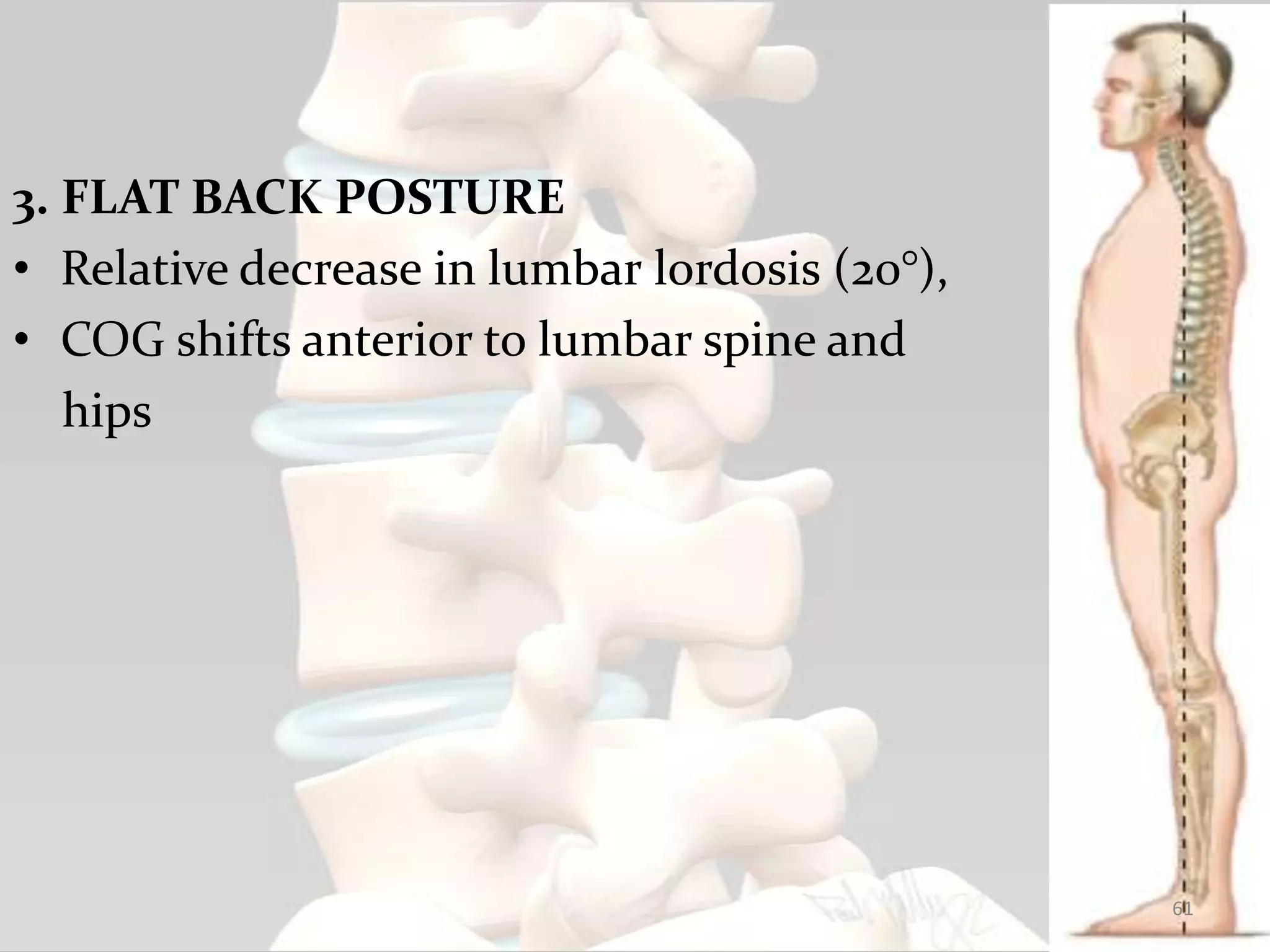 Biomechanics of lumbar spine | PPTX