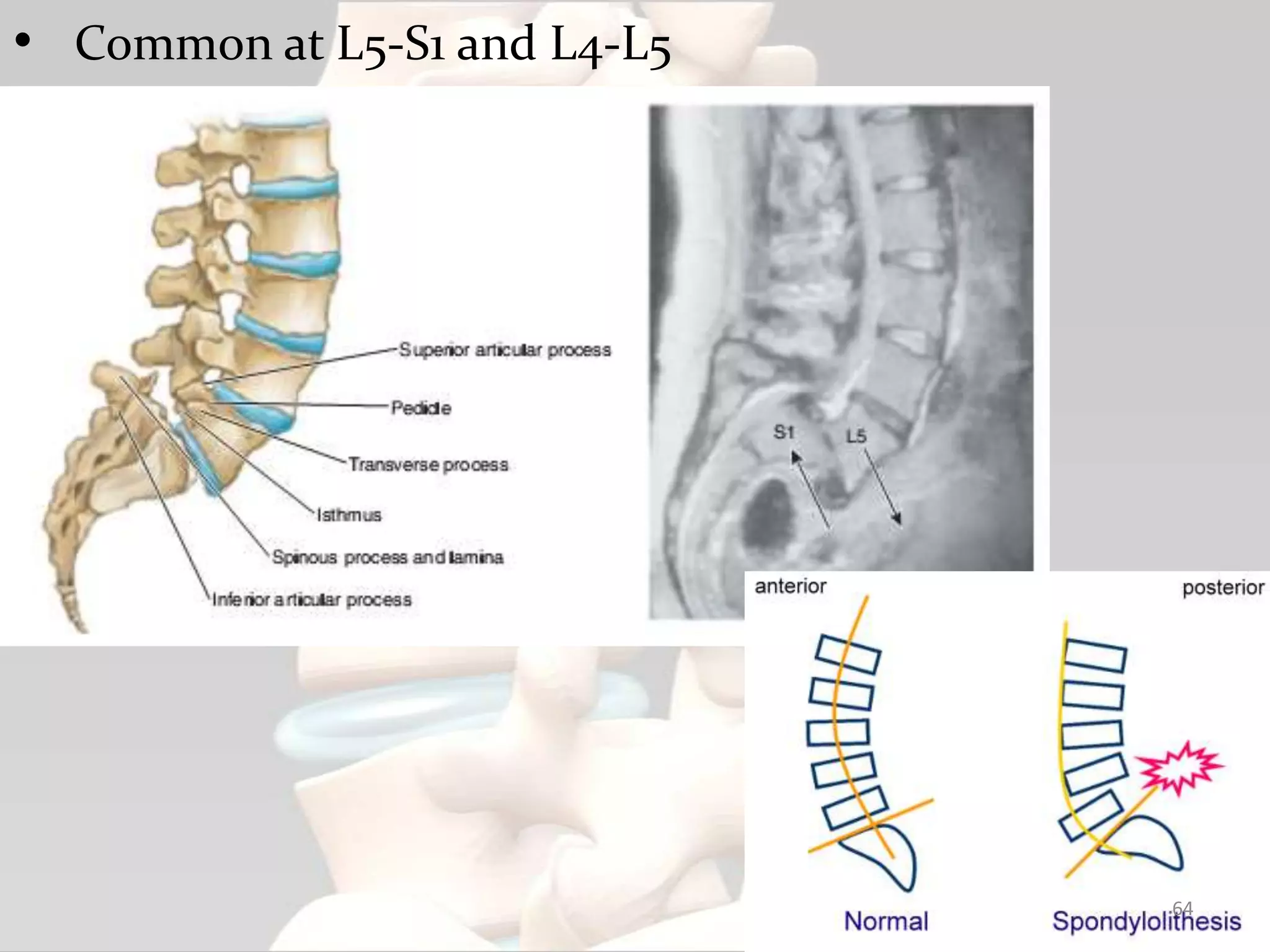 Biomechanics of lumbar spine | PPTX