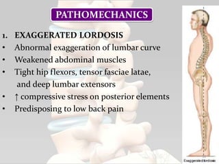 Lumbar Vertebrae Anatomy Ppt
