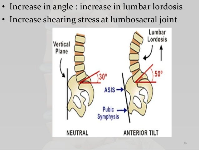 Biomechanics of lumbar spine