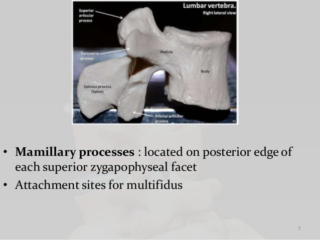 Lumbar Vertebrae Mammillary Process Surgery Of The Thoracolumbar Spine