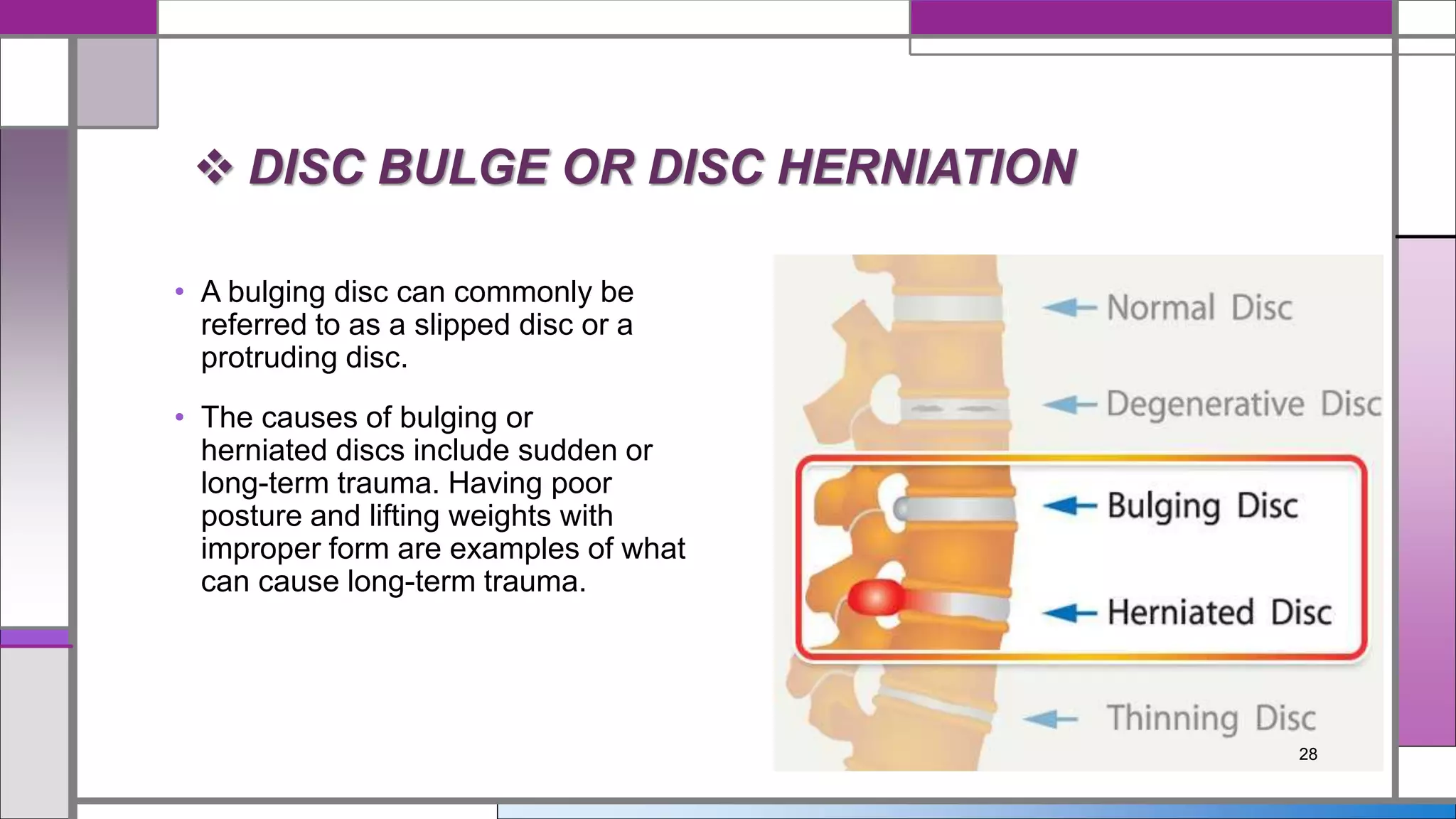 Biomechanics of lumbar spine | PPTX