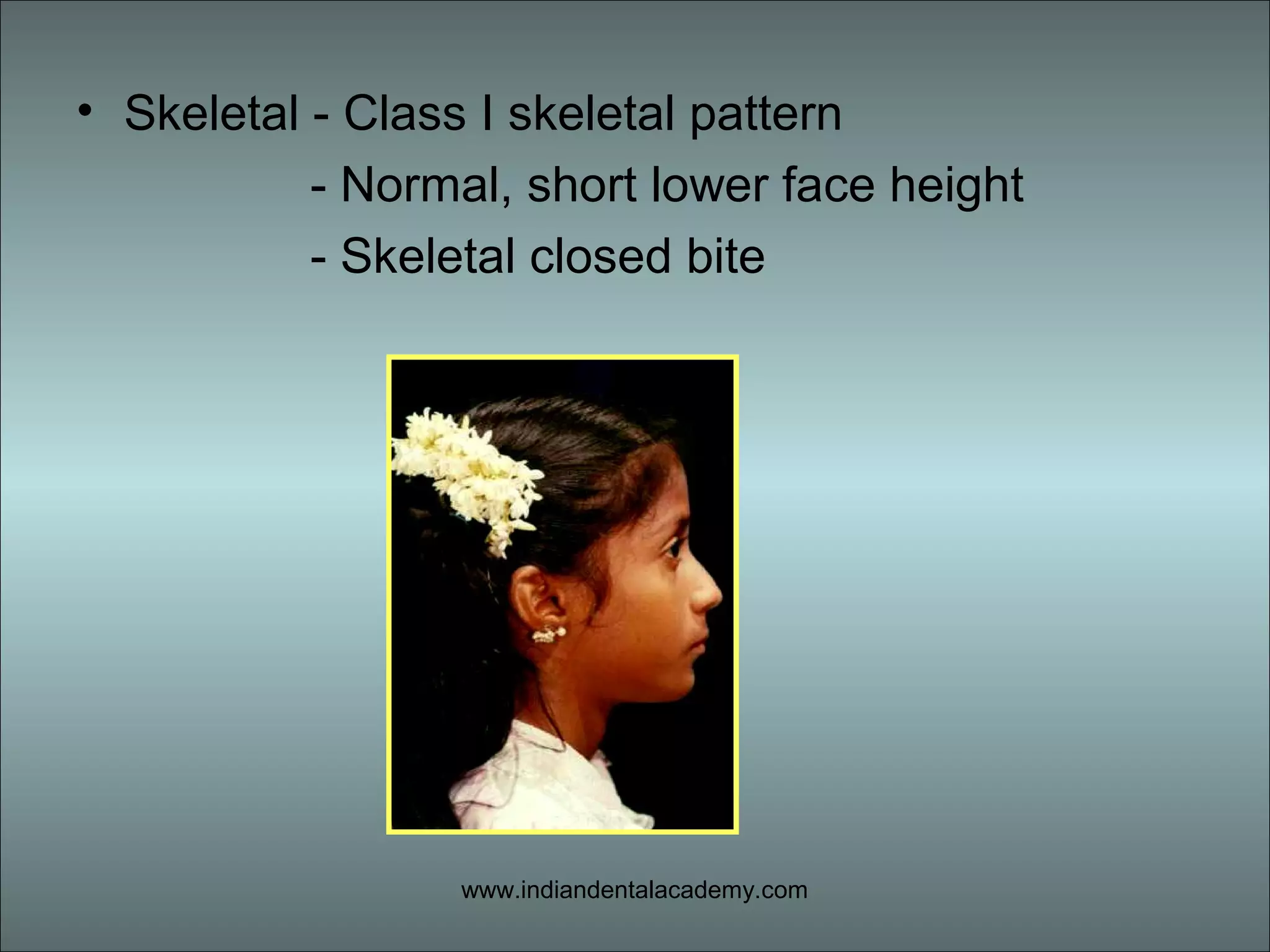 Biomechanics of molar distalization | PPT | Dental Health | Diseases ...