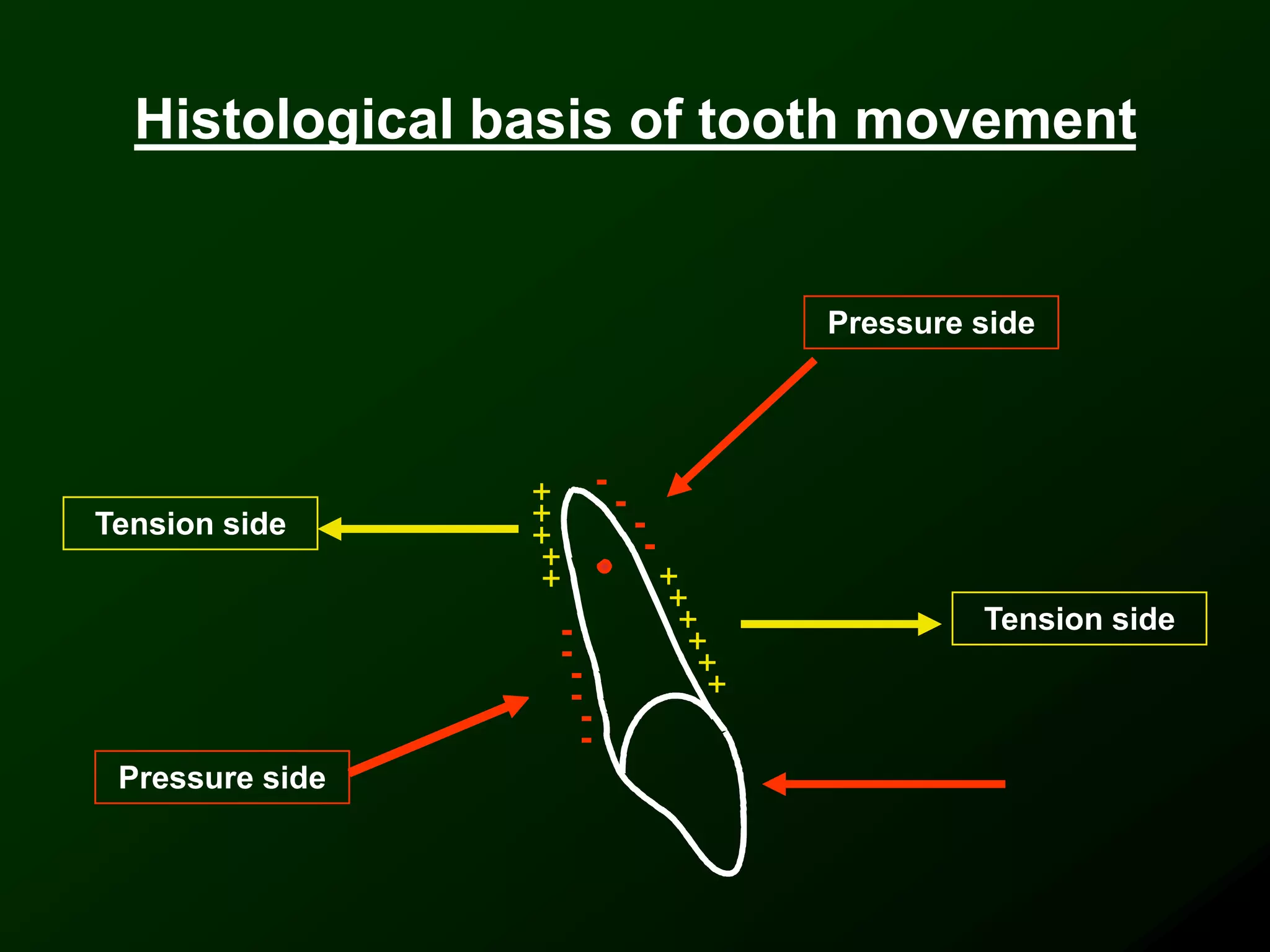 Biomechanics of Orthodontic Tooth Movement _2 - Dr. Nabil Al-Zubair | PPTX